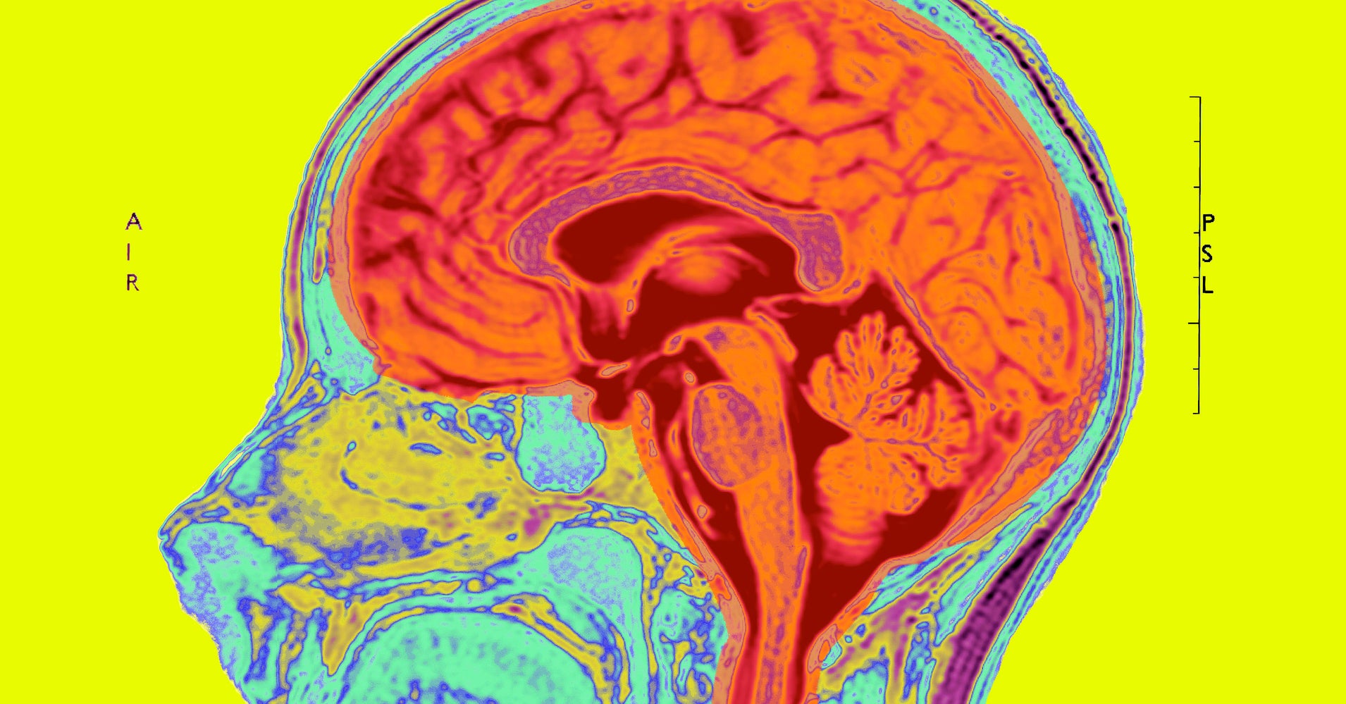 Can We Create An Artificial Brain HuffPost Can We Create An Artificial Brain HuffPost