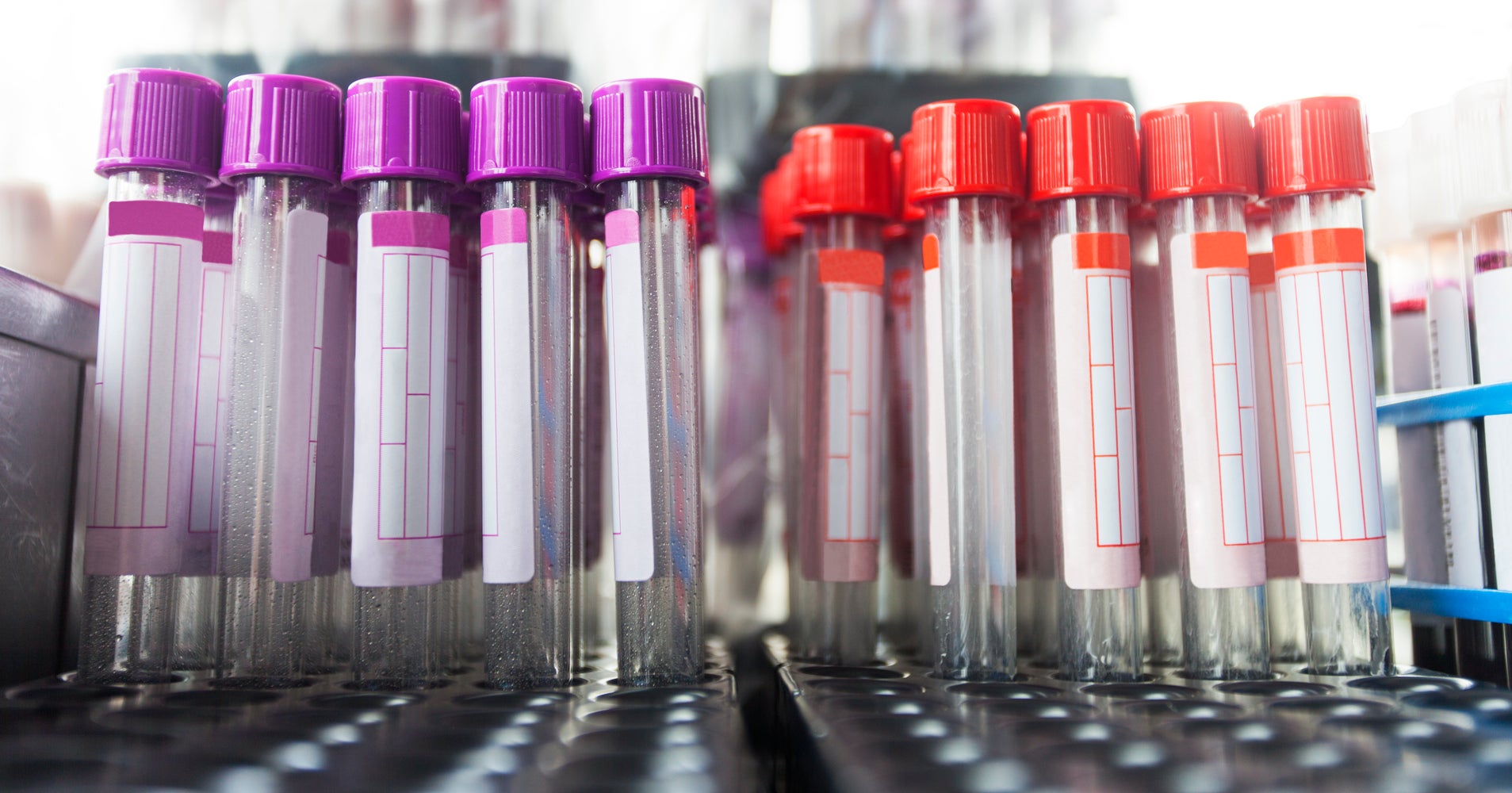 How Well Are You Aging This Blood Test May Tell You HuffPost How Well Are You Aging This Blood Test May Tell You HuffPost