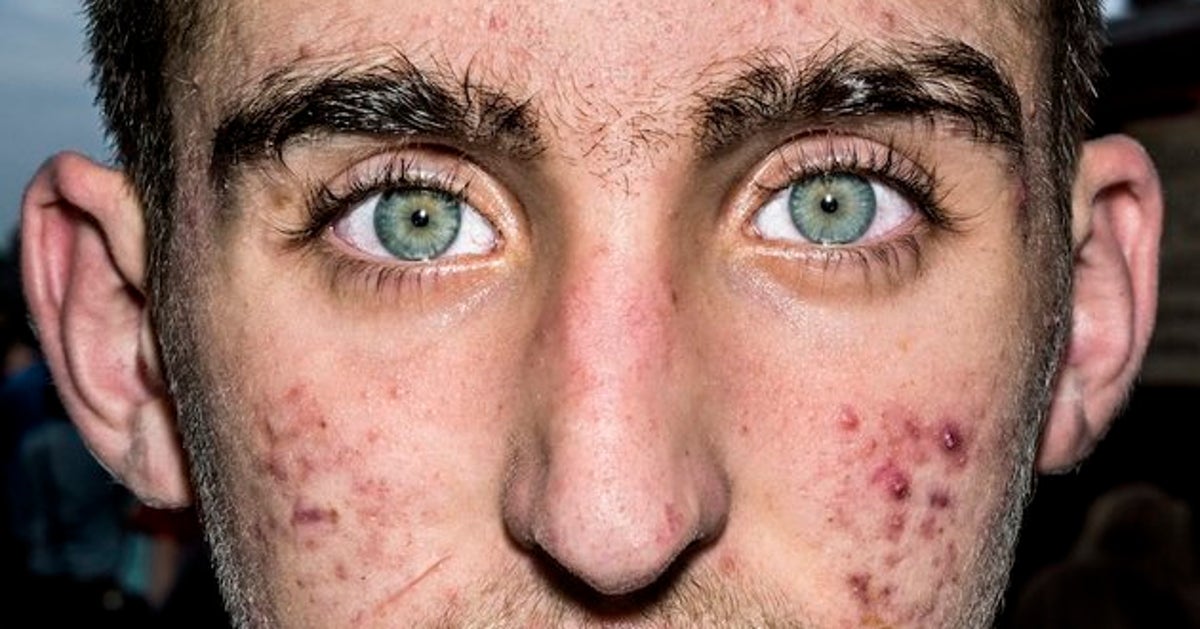 Painfully Close Photos Of Human Faces Look Strangely Inhuman | HuffPost ...