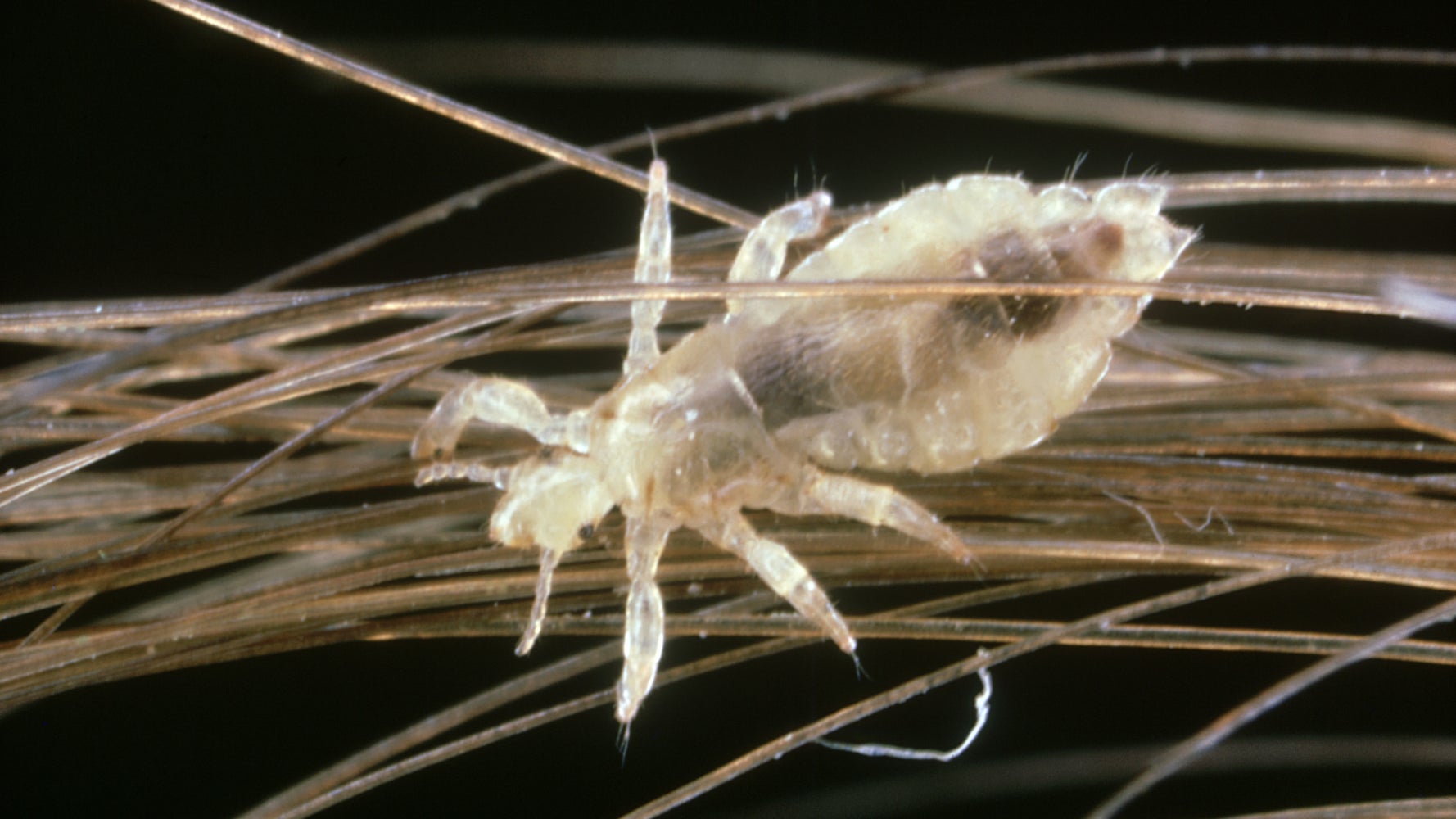 America's Lice Are More Powerful Than Ever This Year | HuffPost