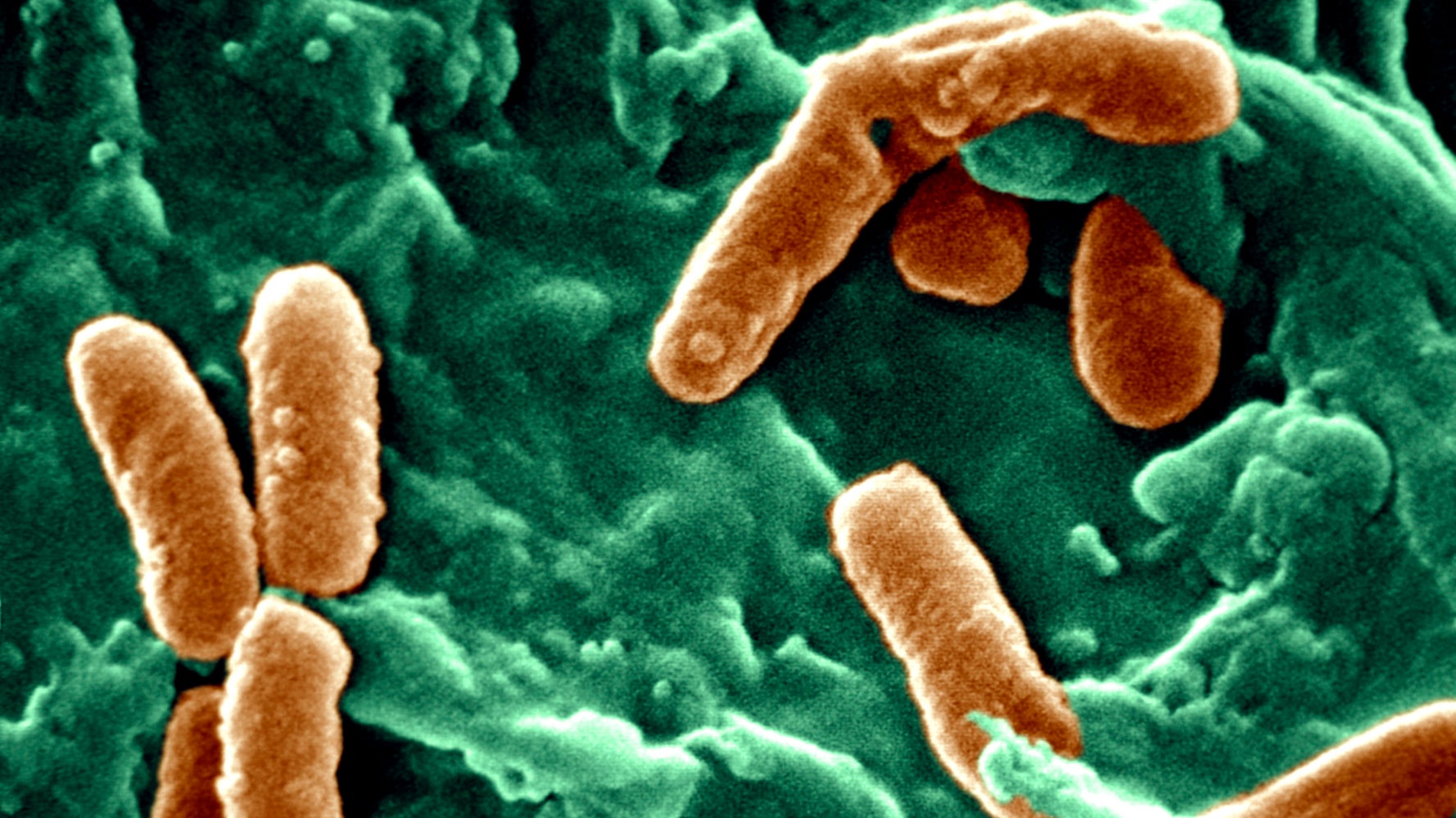 Antibiotic-Resistant 'Superbug' Found At California Hospital | HuffPost ...