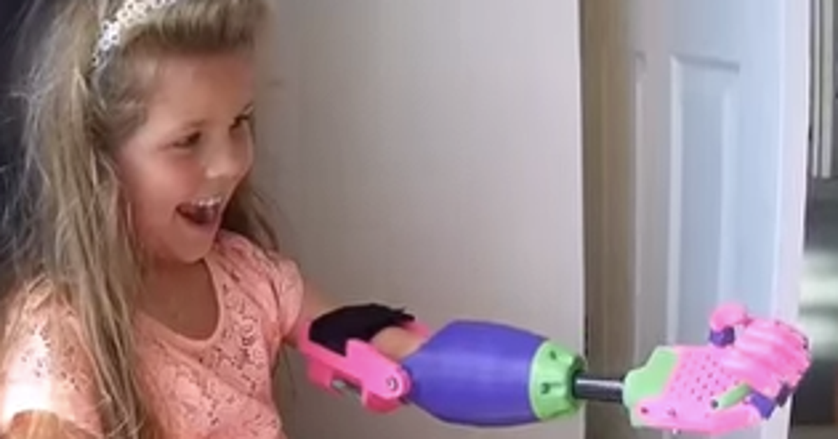 Watch This Girl Open Her 3D-Printed Arm And Get The World In Her Grasp ...