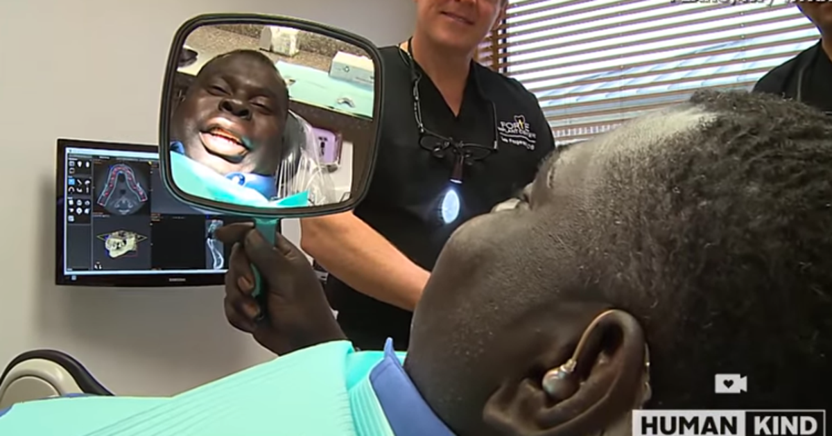 Formerly Homeless Man Once Ashamed Of Teeth Gets New Smile From Kind ...