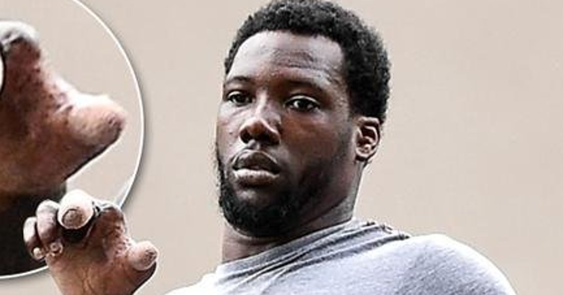 Oh, Man, Does Jason Pierre-Paul’s Hand Look Mangled Or What? | HuffPost