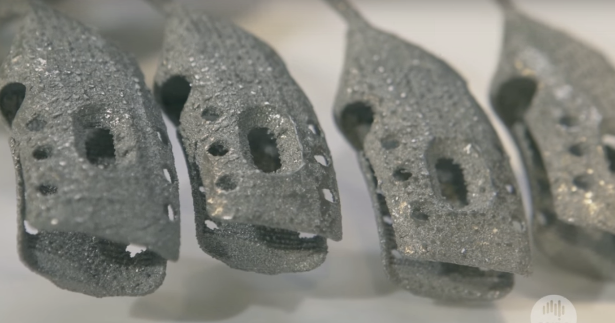 6 Amazing 3D-Printed Body Parts That Changed Patients' Lives | HuffPost ...