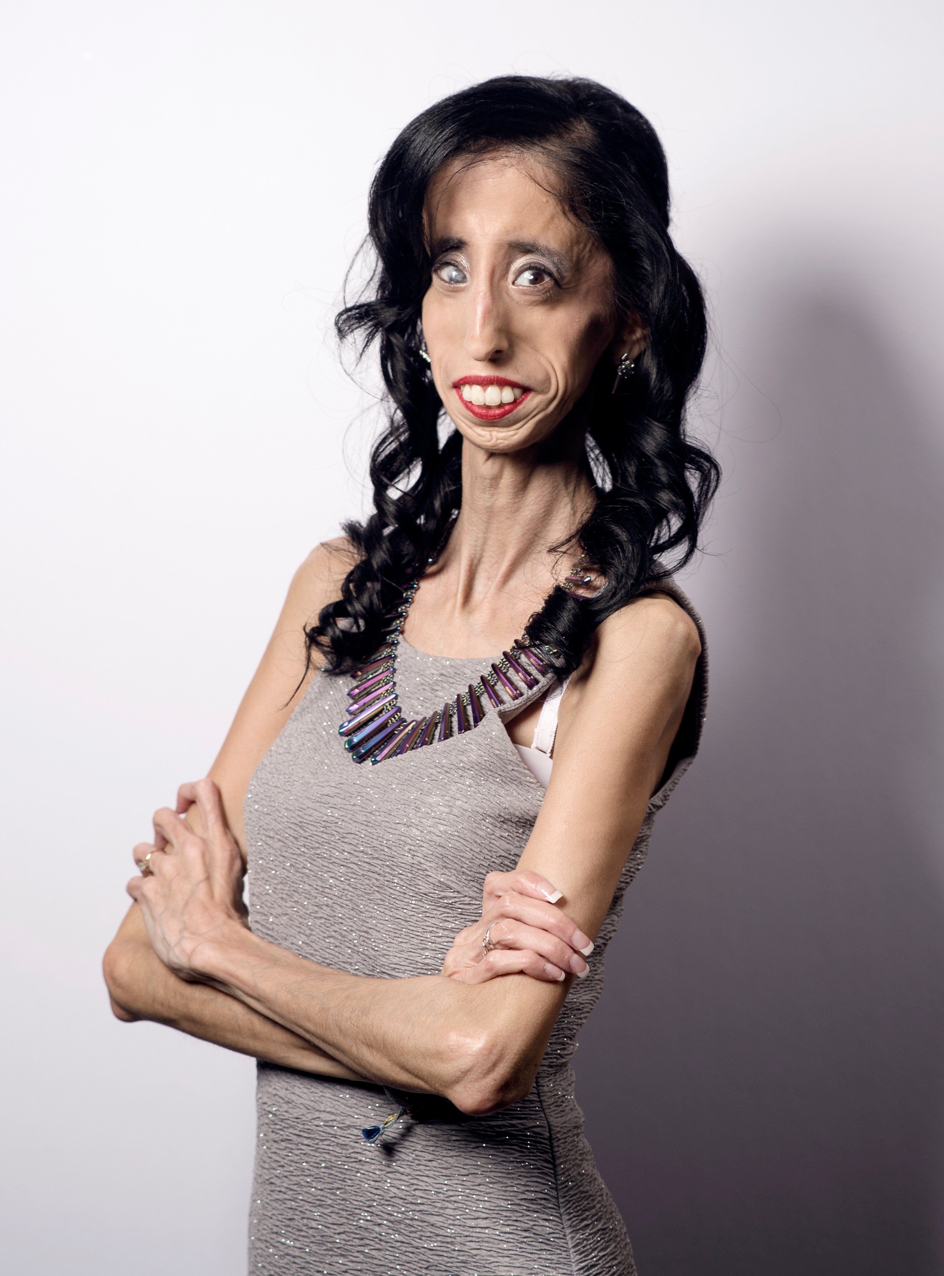 Mulher Magra E Feia BRAINCP Mulher Magra E Feia BRAINCP