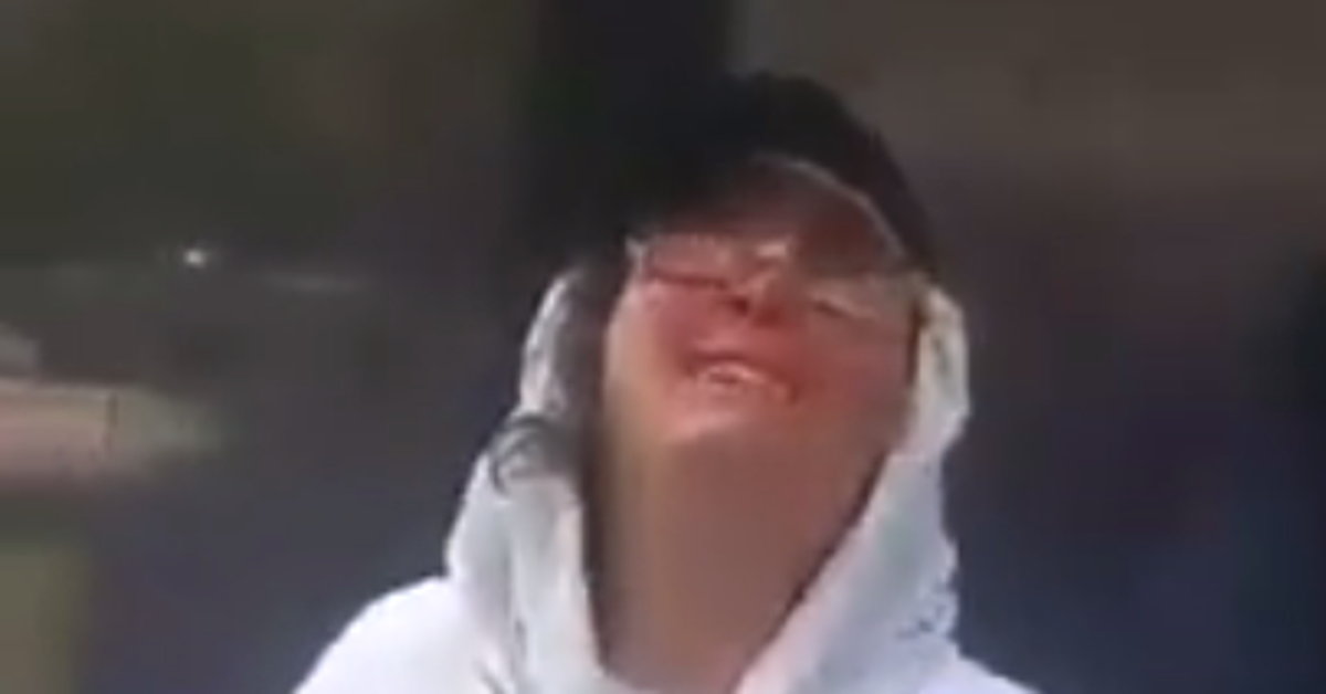 Watch An Acid Attack Survivor Fully See The World For The First Time In ...