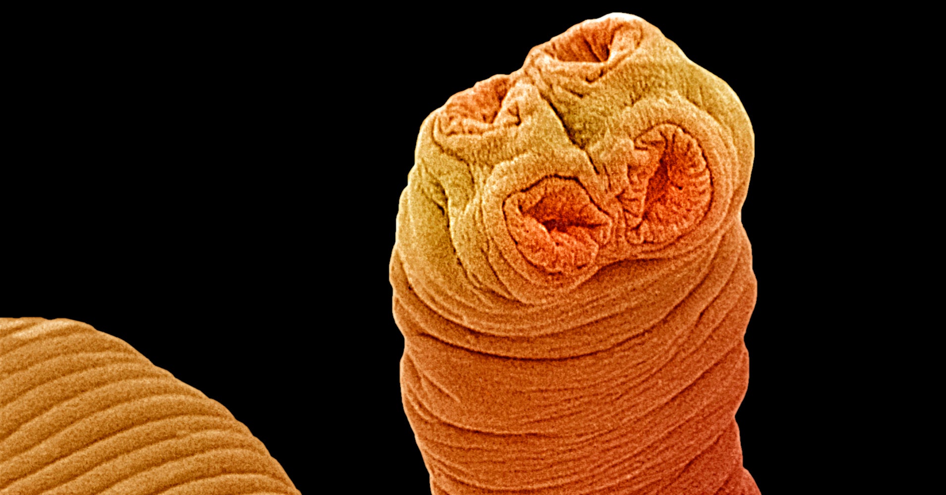 Cancer-Ridden Tapeworm Gave Man Tumors, CDC Determines | HuffPost