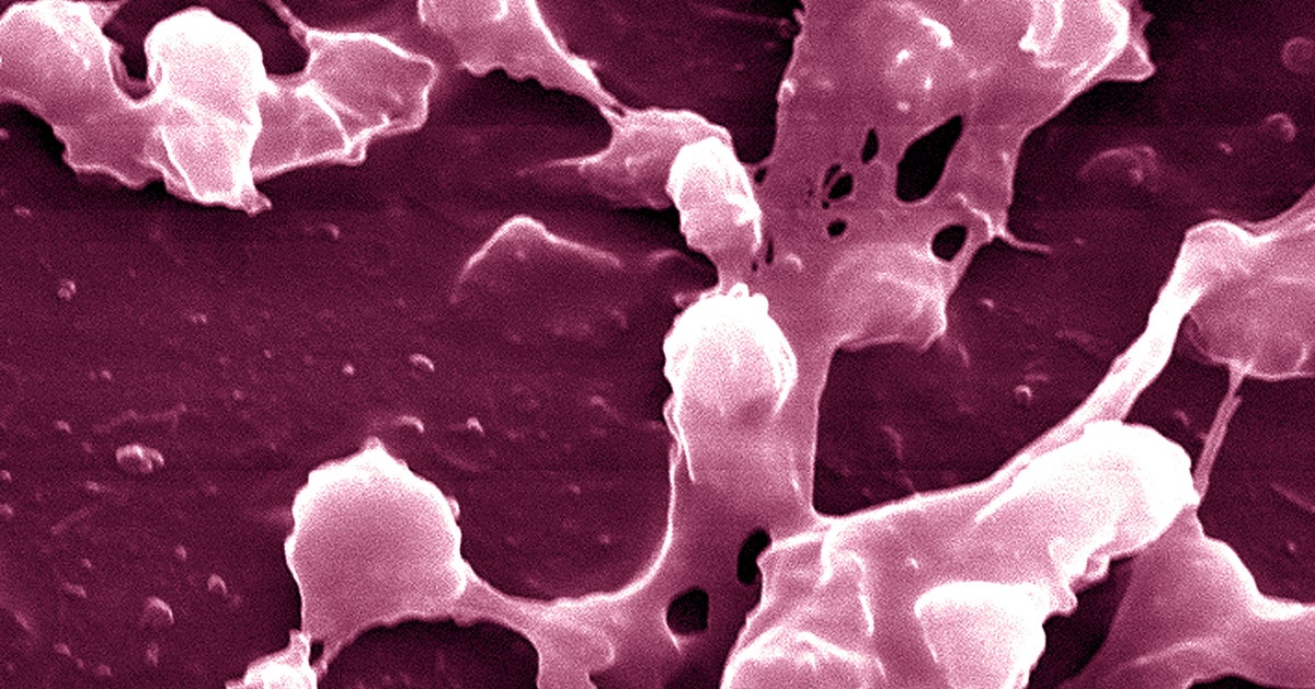 Antibiotics May Make 'Superbug' MRSA Stronger | HuffPost Impact