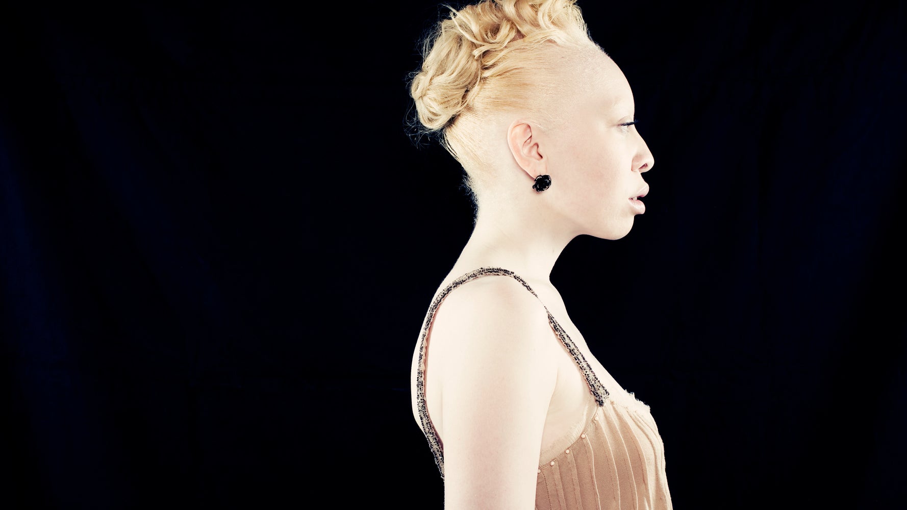People Of Color With Albinism Ask: Where Do I Belong? | HuffPost