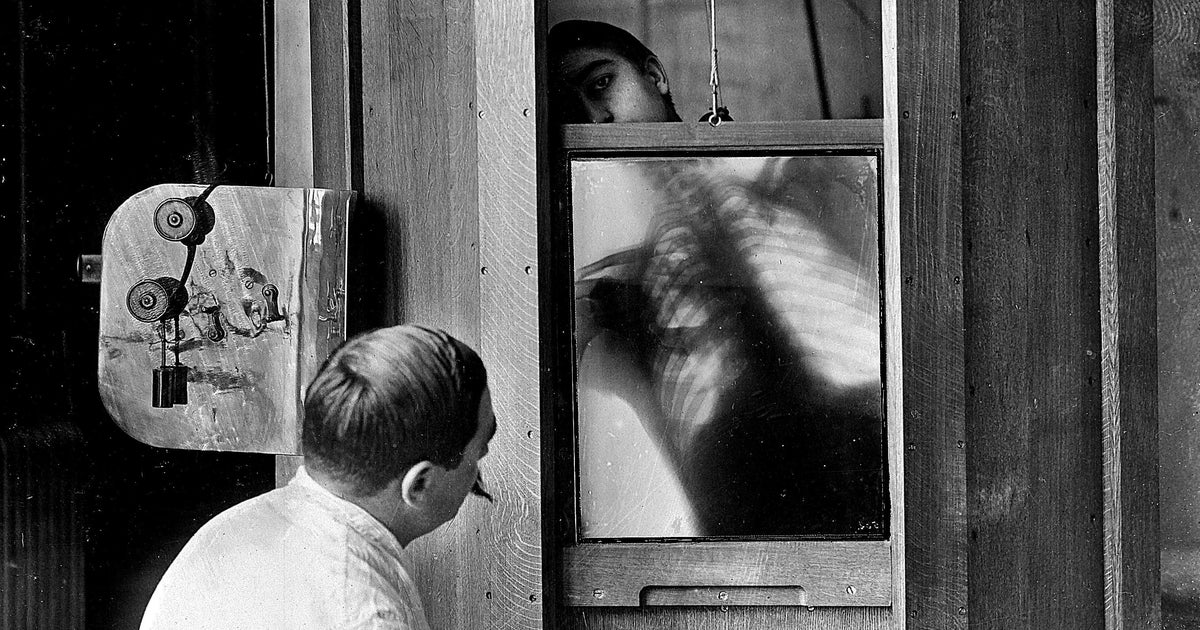 27 Crazy Images Of Medical Treatments Through History | HuffPost Life