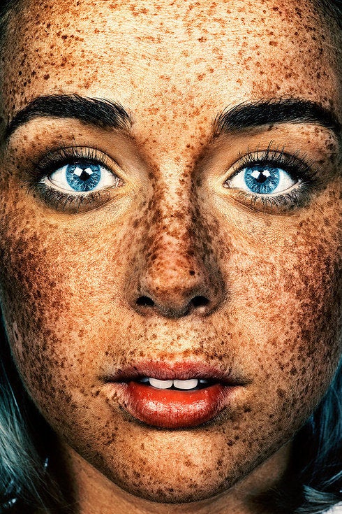 The Fabulously Freckled Get Their Close Up In Photo Project Huffpost