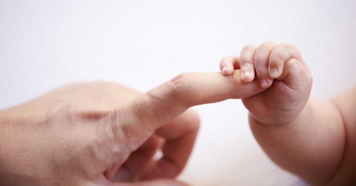 This Serious Birth Defect Is On Rise In The U.S. | HuffPost Life