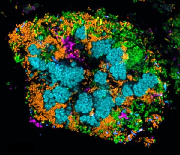 Far-Out Photos Reveal The Beautiful Bacteria Living In Our Teeth | HuffPost