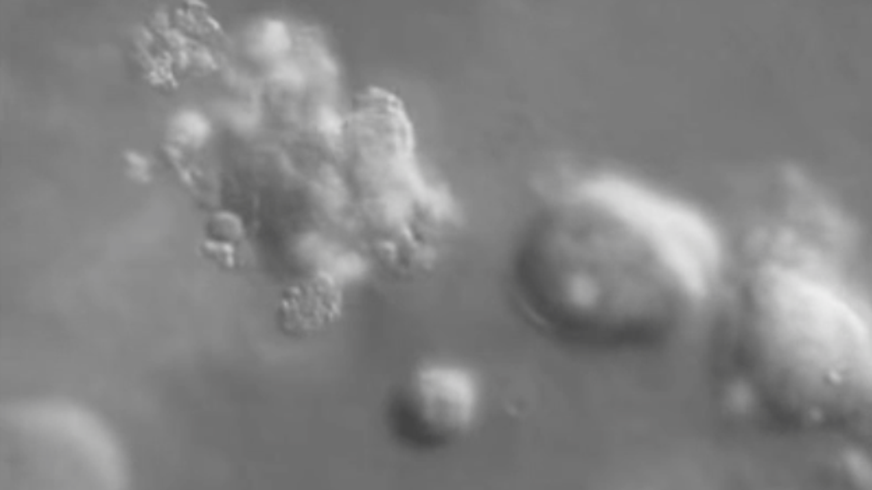 This Is What It Looks Like When Cancer Cells Form Tumors | HuffPost