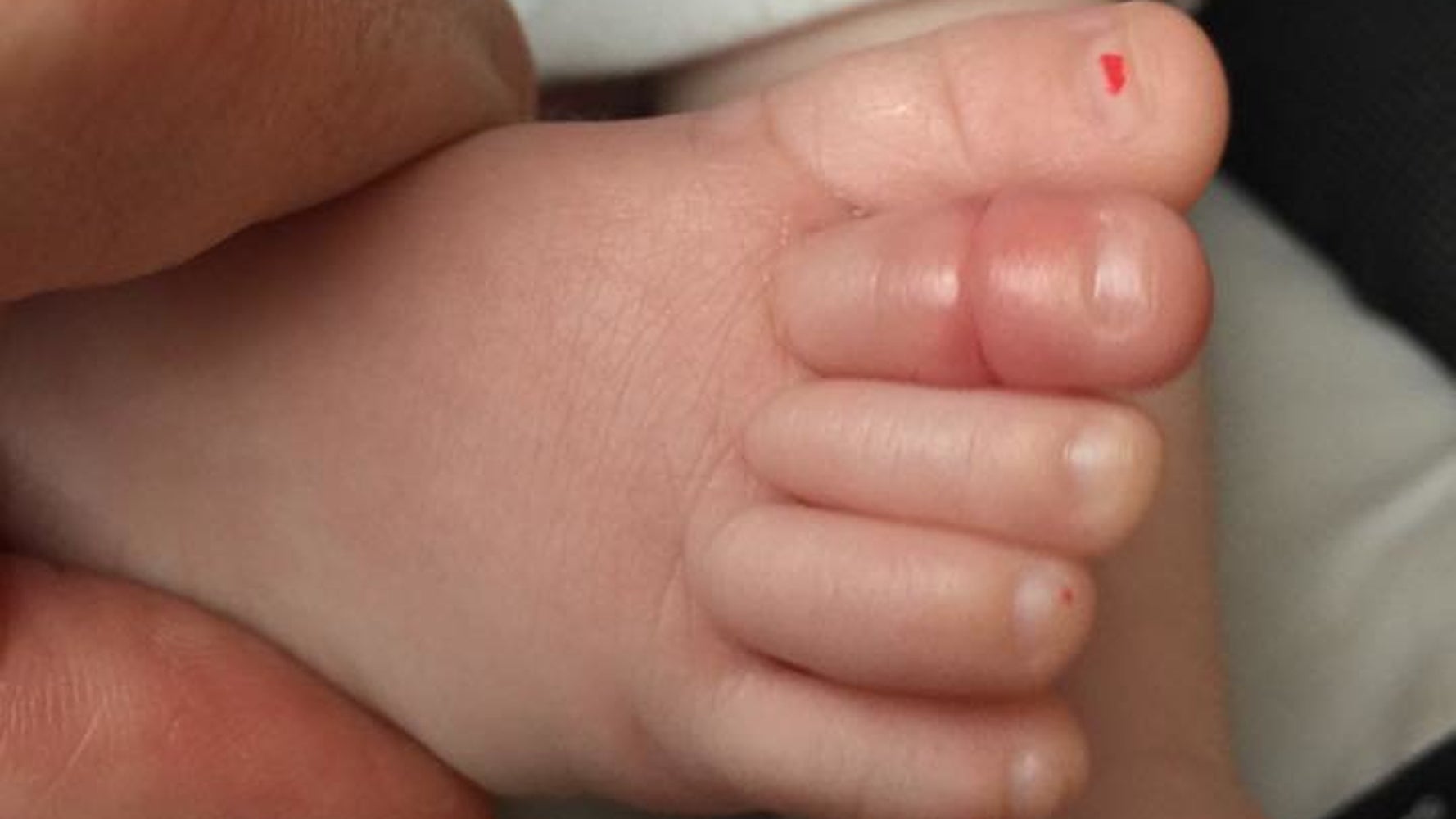 Dad Shares Warning About Infant Injury Many Parents Don't Know About ...