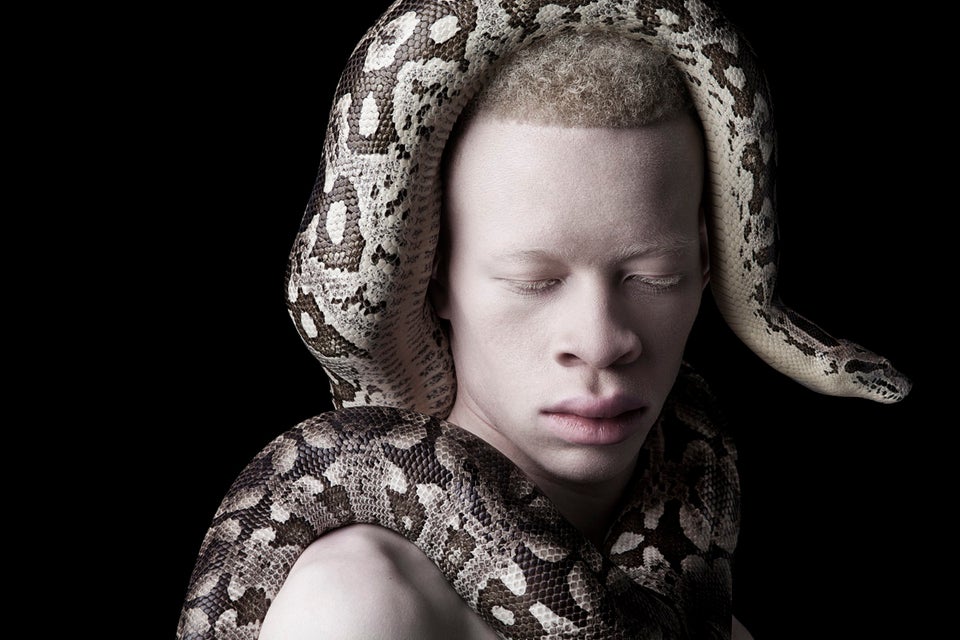 Stunning Photos Of Models With Albinism Capture The Beauty In Breaking ...