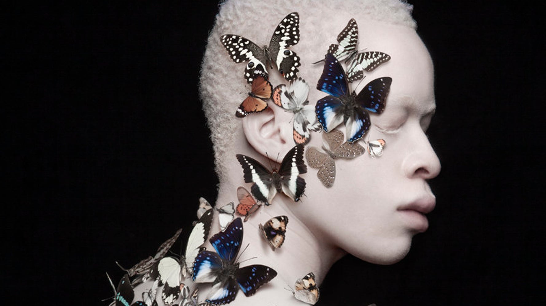 Stunning Photos Of Models With Albinism Capture The Beauty In Breaking ...