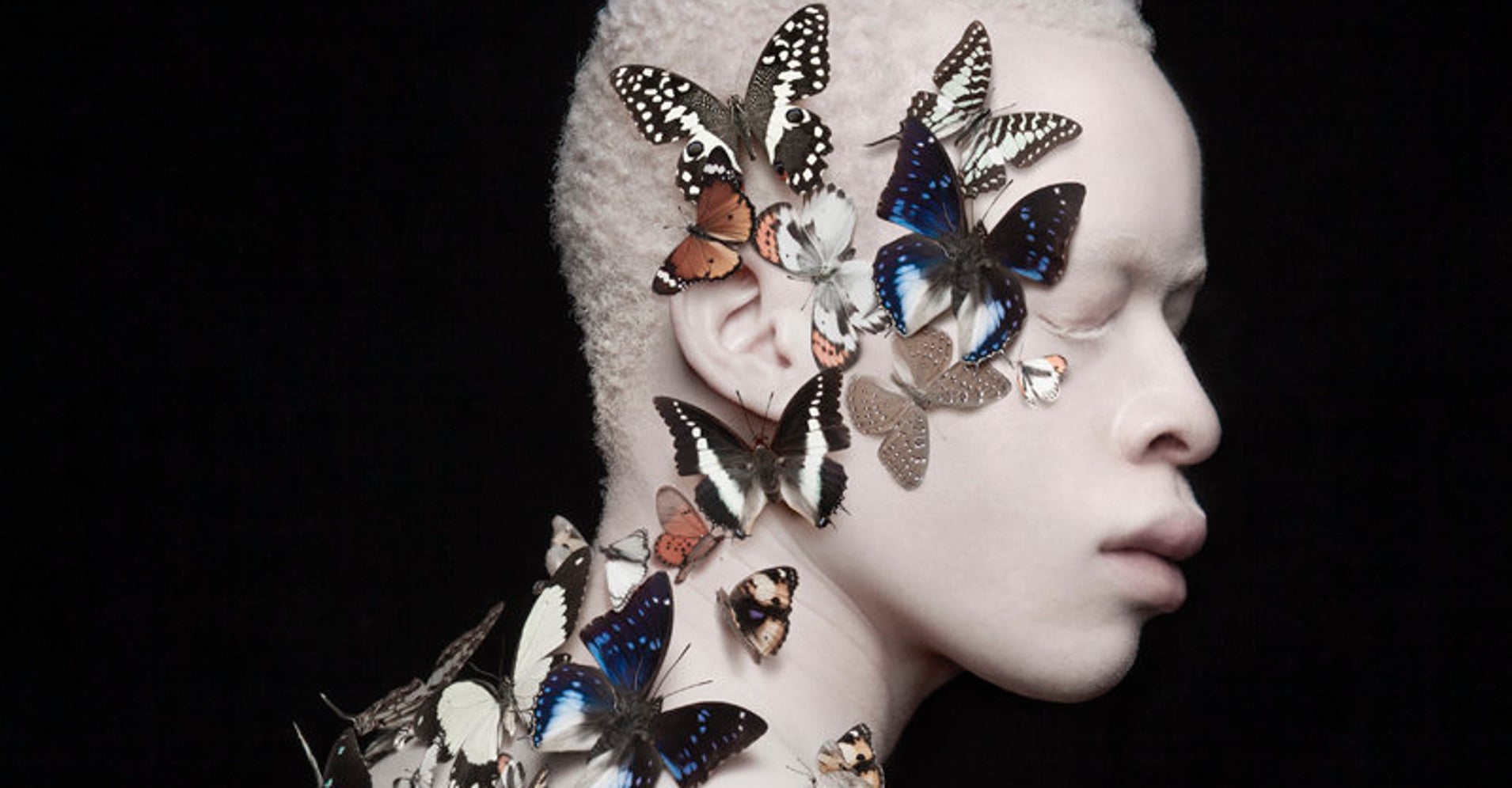 Stunning Photos Of Models With Albinism Capture The Beauty In Breaking ...
