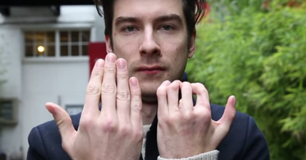 Actor Finds Upper Hand After Having His Fingers Replaced With Toes ...