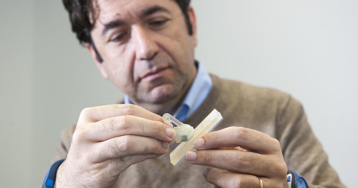 This Brilliant Bionic Fingertip Just Changed An Amputee's Life ...