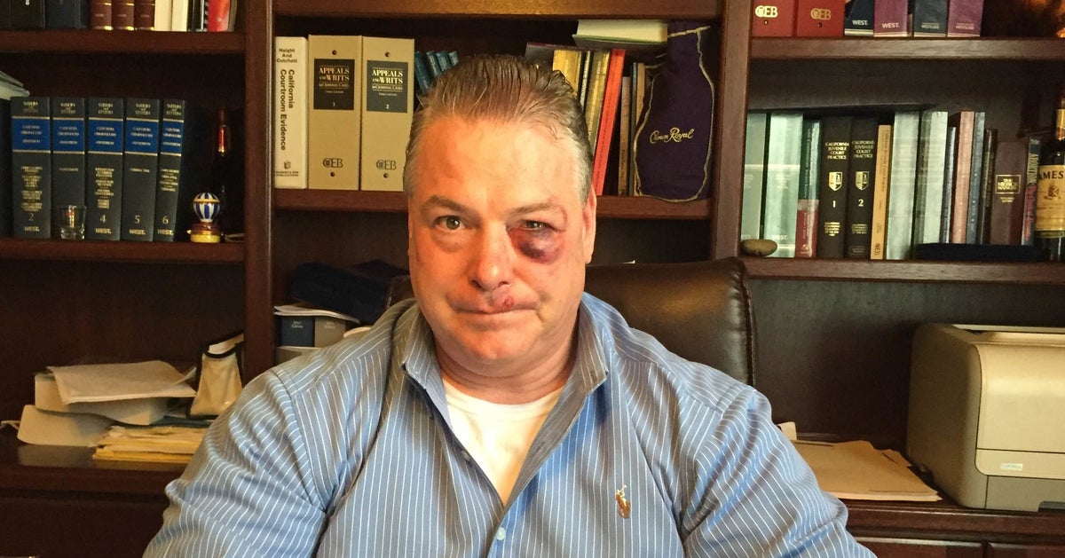 Beating Of Defense Attorney Could Be Last Straw For Embattled DA's ...