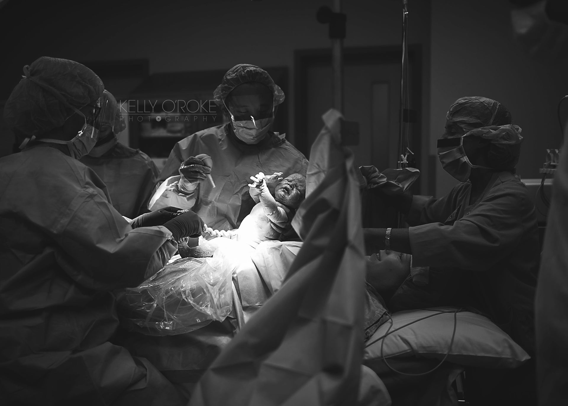 15 Intimate Birth Photos That Show How Beautiful C-Sections Can Be ...