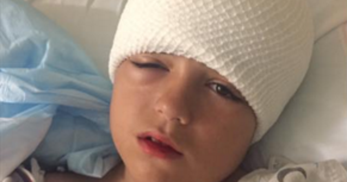 Mum Warns Parents About The Importance Of Cycle Helmets After Fall From ...