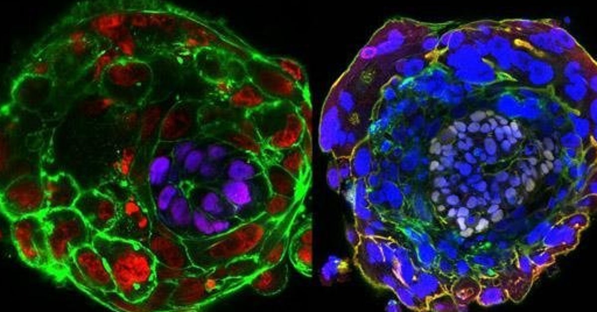 Human Embryos Kept Alive In Lab For Unprecedented 13 Days, Could Lead ...