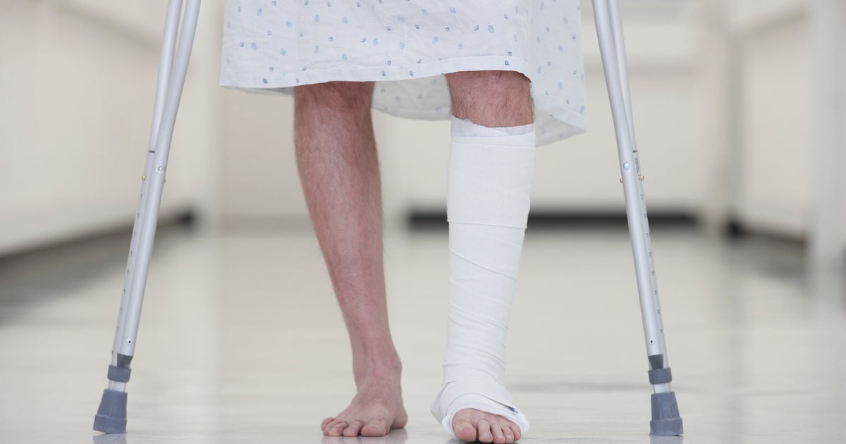 What Happens To Your Body When You Break A Bone HuffPost UK Life what-happens-to-your-body-when-you-break-a-bone-huffpost-uk-life