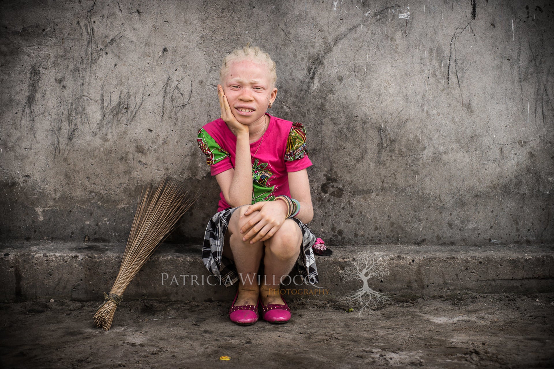 Photographer Fights The Stigma Of Albinism With Stunning Photo Essay ...