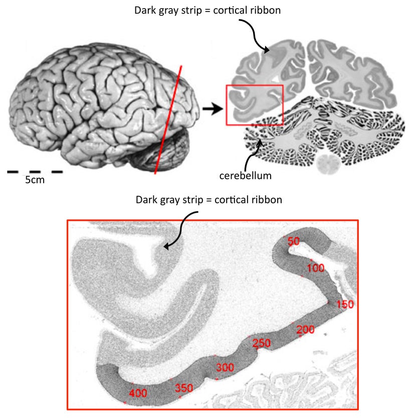 Let's take a walk along the cortical ribbon | HuffPost