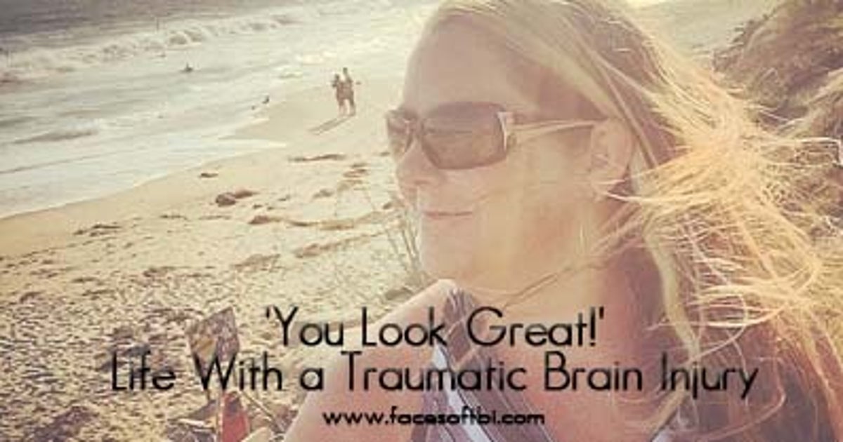 'You Look Great!' -- Life With A Traumatic Brain Injury | HuffPost Life