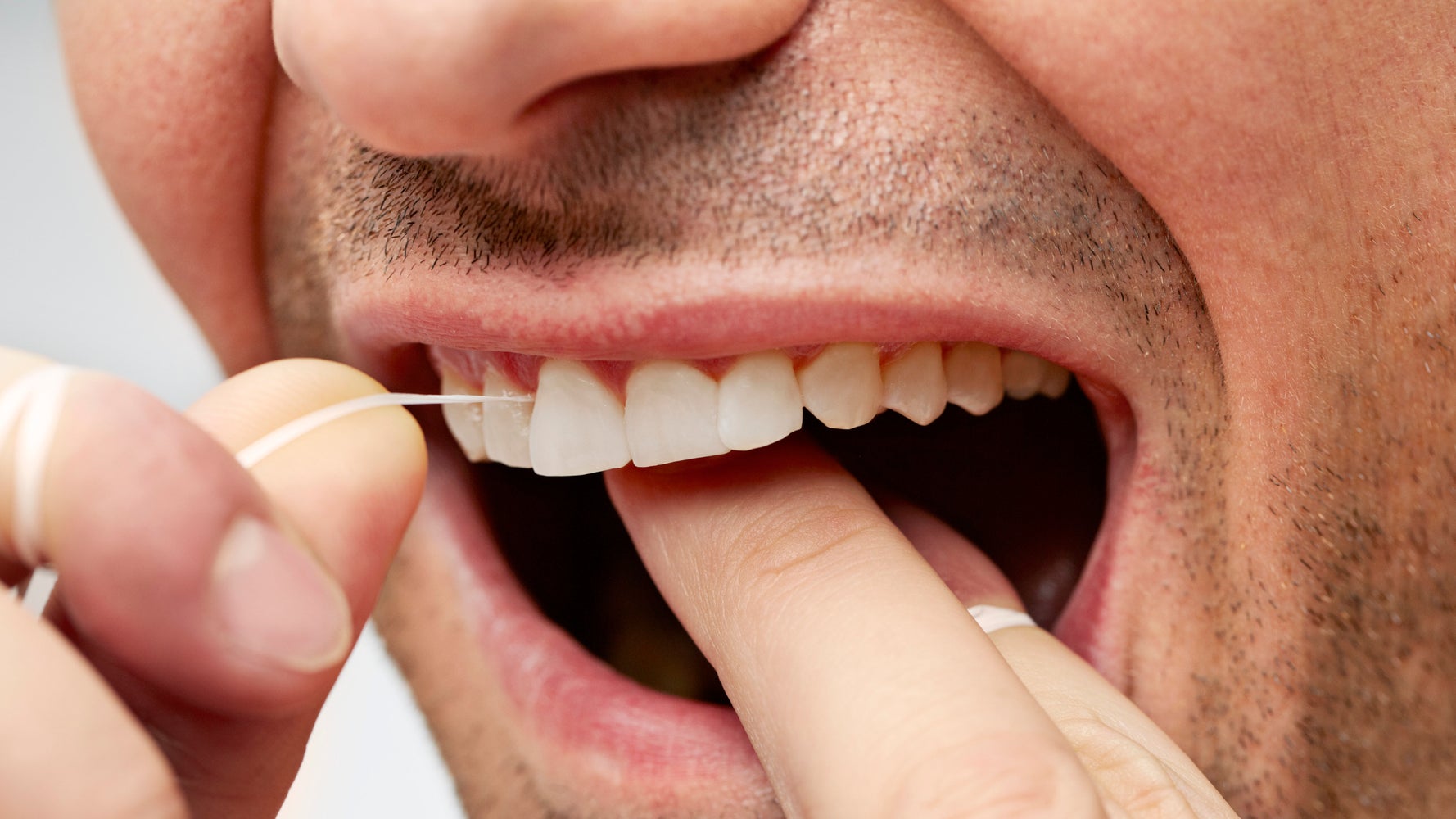 Flossing Teeth: 'Weak Evidence' To Suggest It Prevents Gum Disease And ...