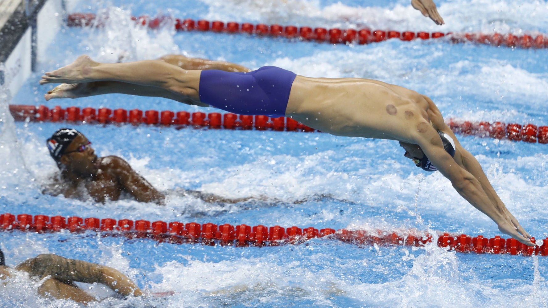 What's Really Behind The Unusual Circles On Michael Phelps' Back ...