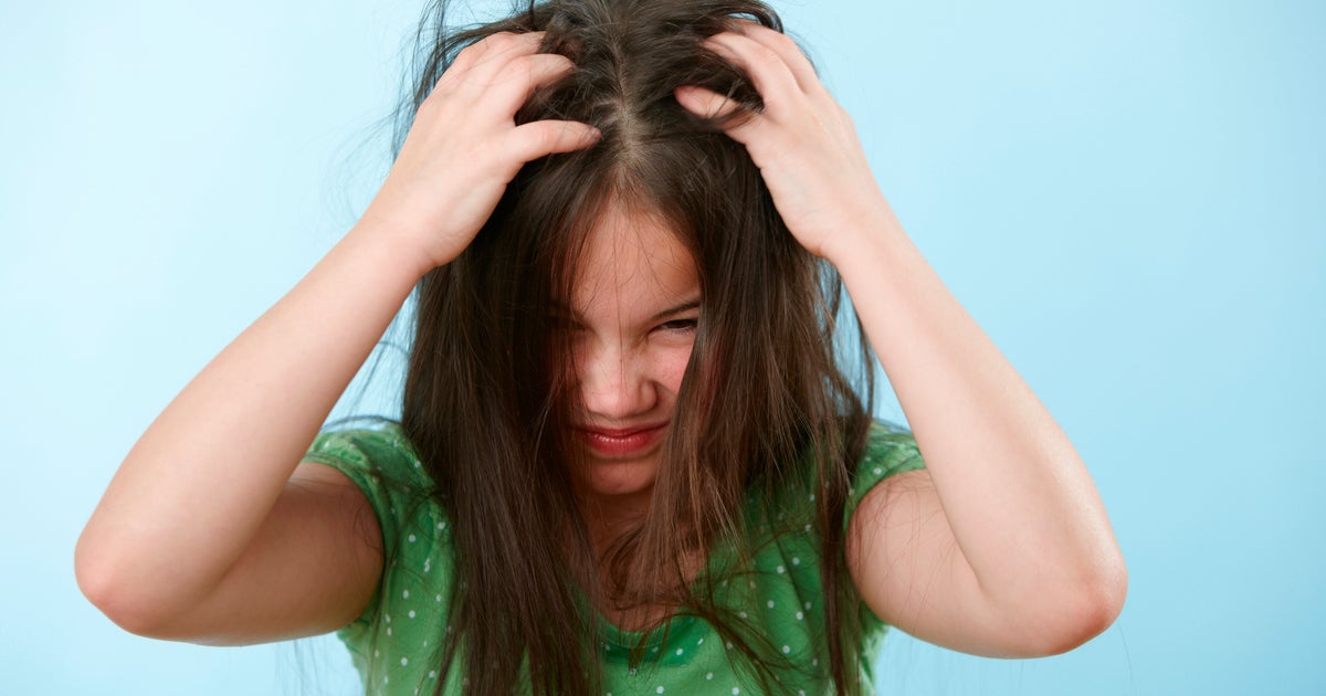 Head Lice: Everything Parents Need To Know About Nits | HuffPost UK Parents