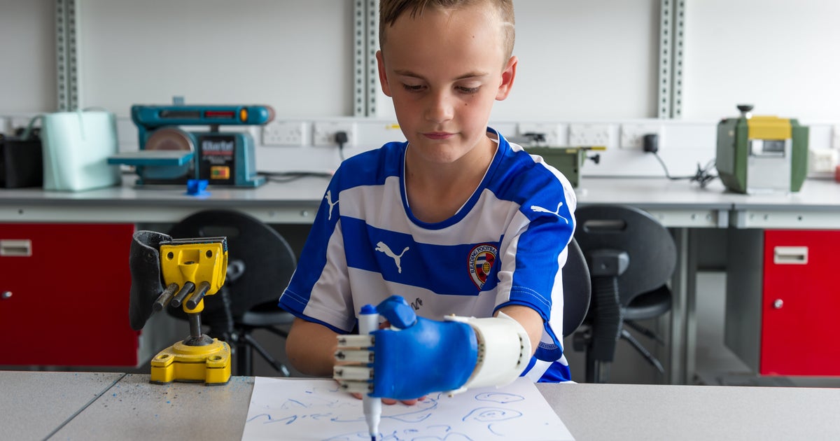 State-Of-The-Art Robotic Hand Given To 8-Year-Old Boy Who's An Aspiring ...