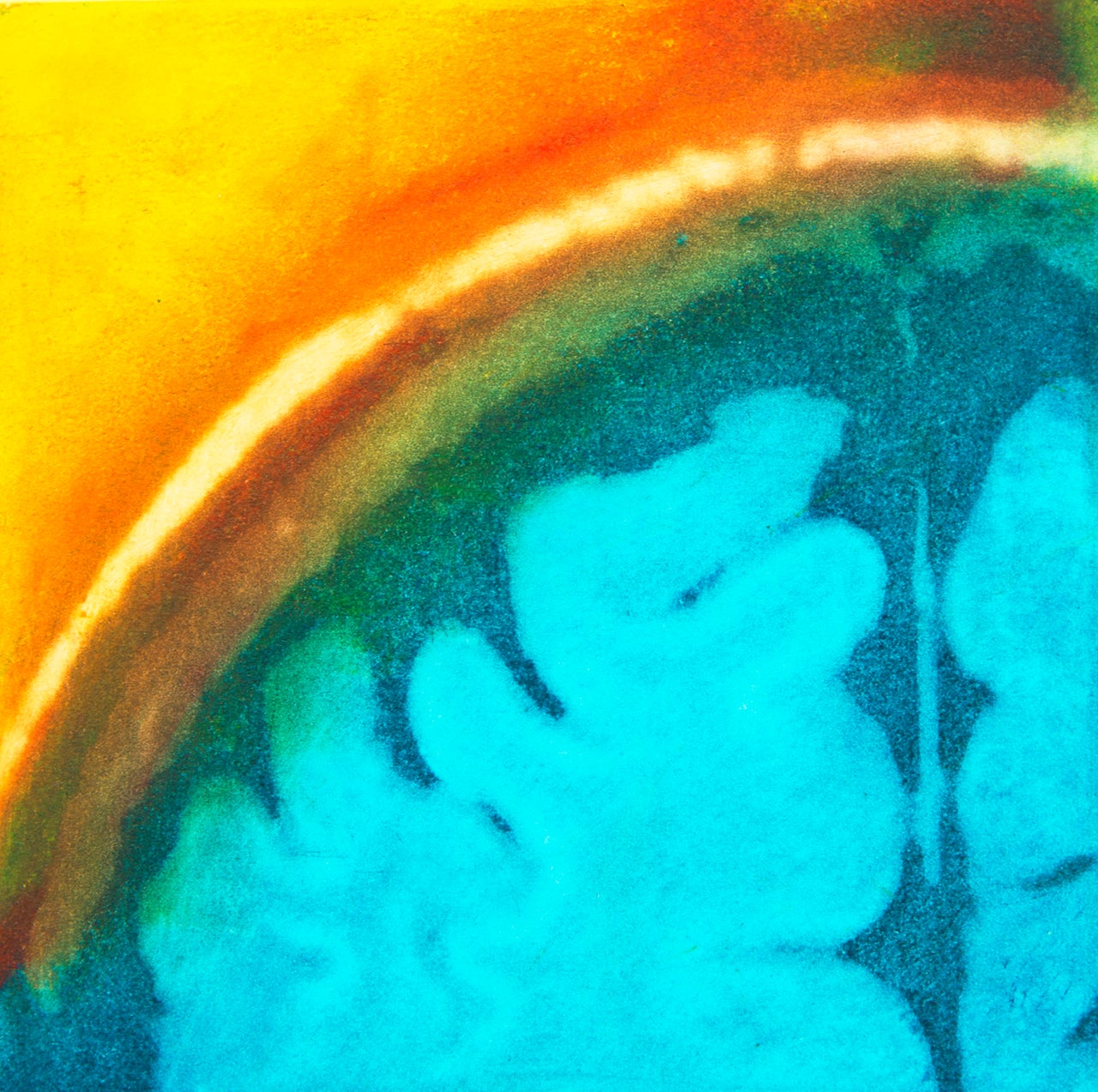 A Woman Diagnosed With MS Is Turning Her Own Brain Scans Into Art ...