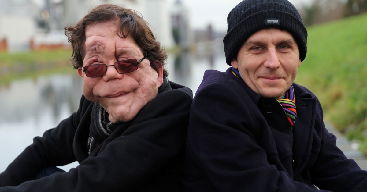 'Horizon: My Amazing Twin' Follows Plight Of Identical Twins Plagued By ...