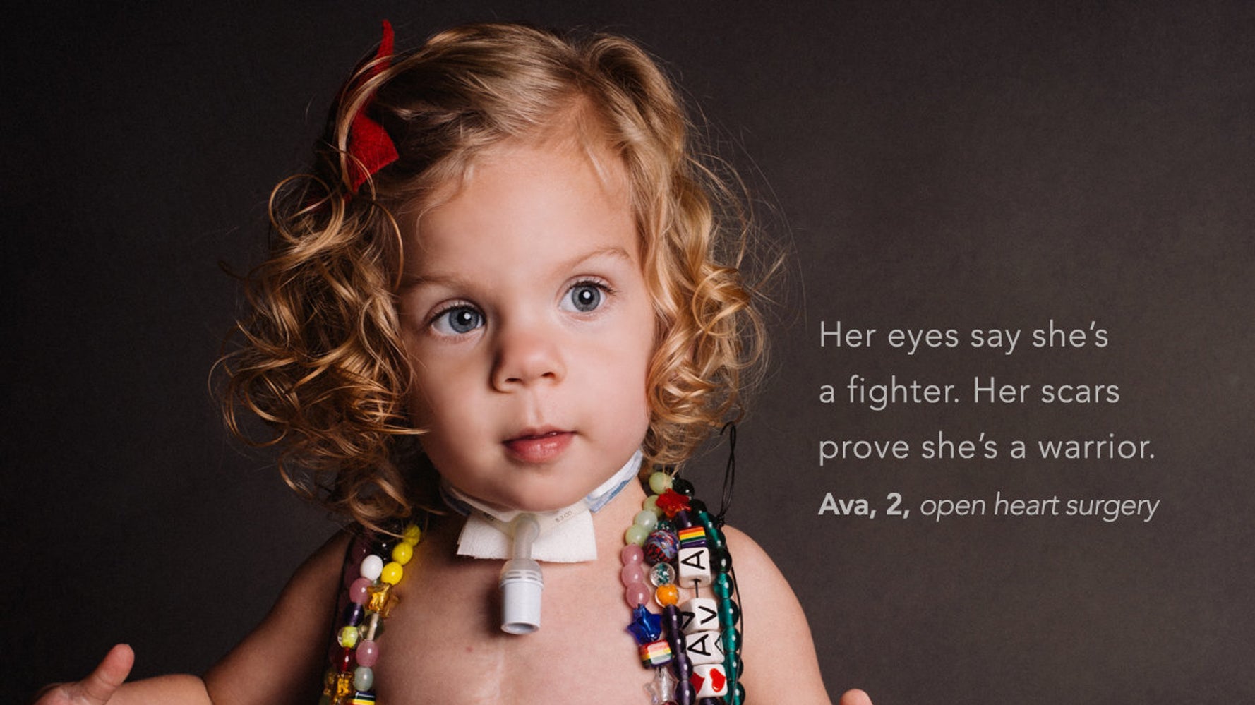 Kids Proudly Show Off Their Scars In Inspiring Photo Series | HuffPost Life