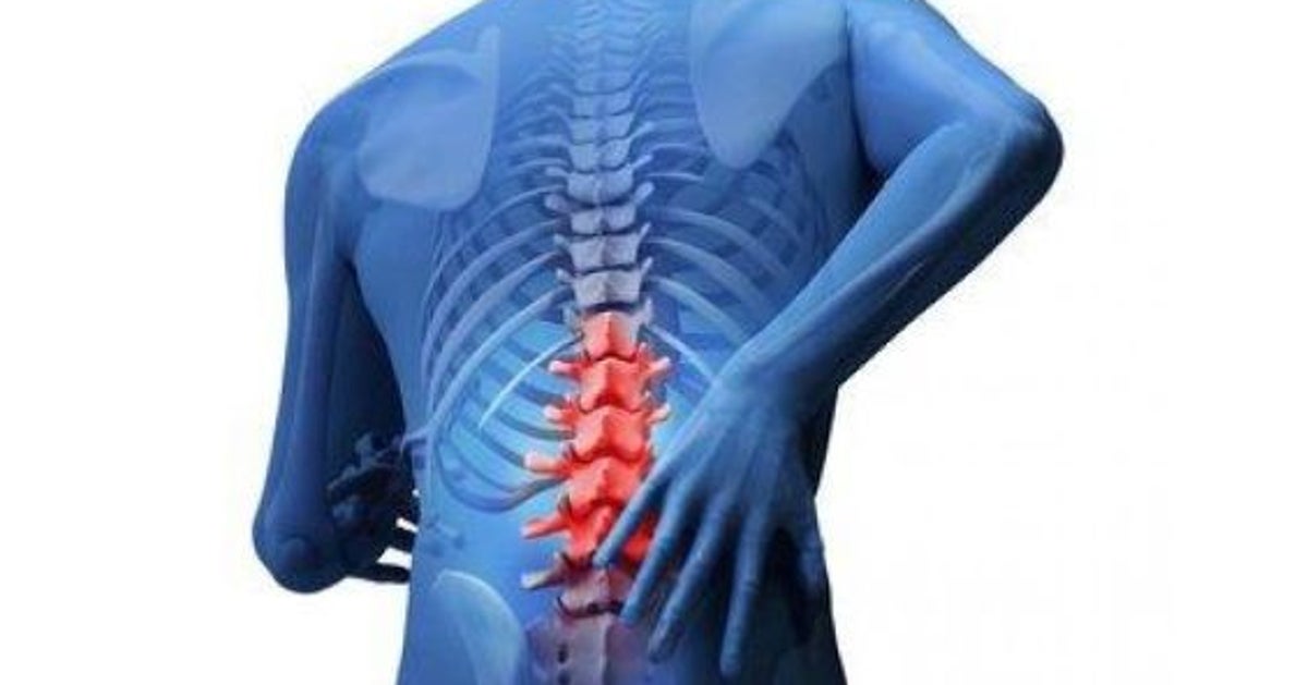 Your 'Bad Back' is a Public Health Crisis. | HuffPost Contributor