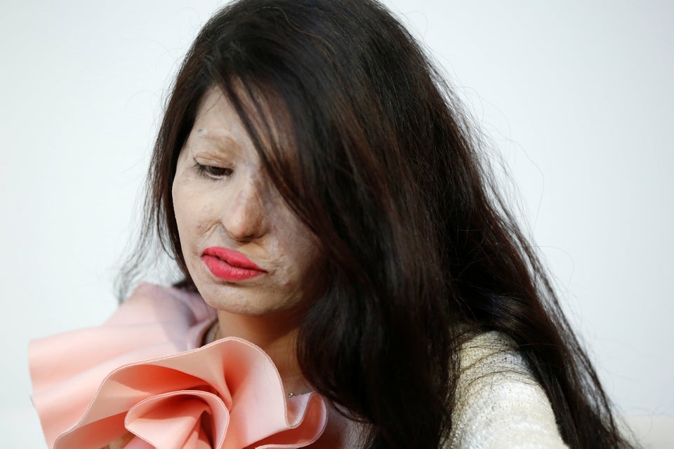 At Age 9, She Survived A Brutal Acid Attack. Here's Her Life 18 Years ...