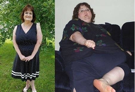 I Dieted My Way To 460 Pounds by Beth Donovan, Certified Coach ...