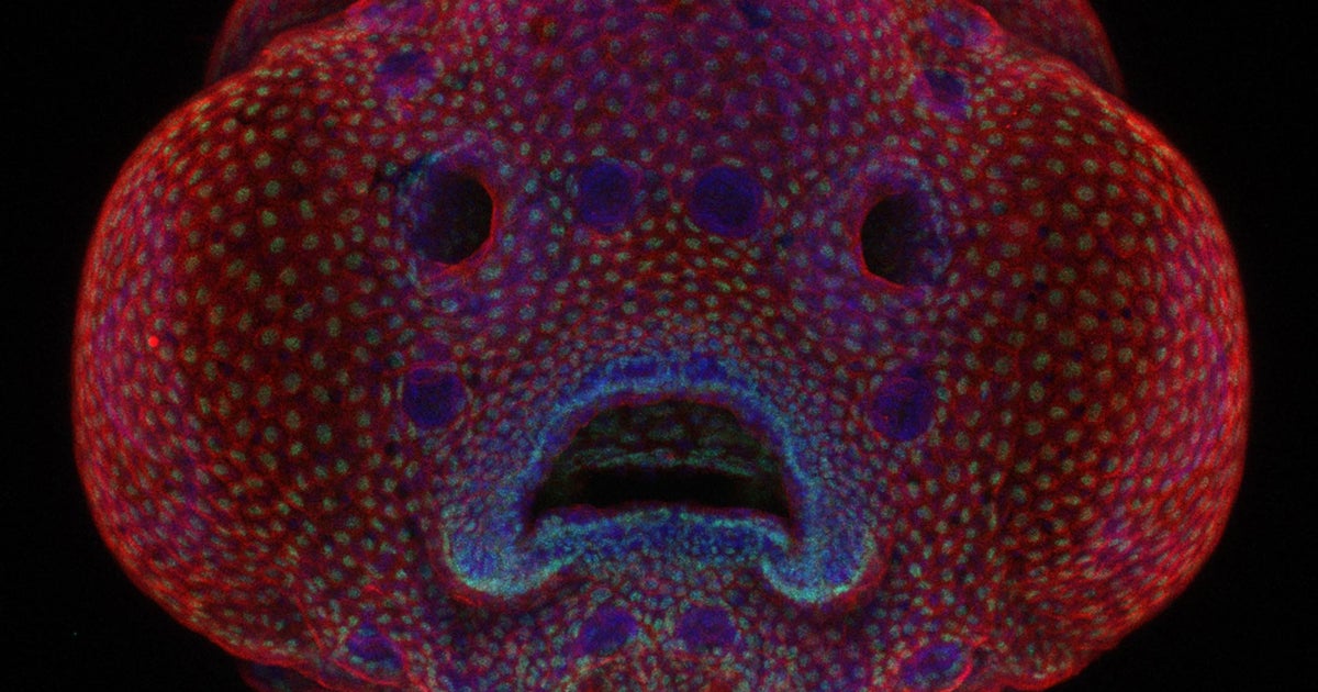 20 Dazzling Photos Of A Bizarre World You Need A Microscope To See ...
