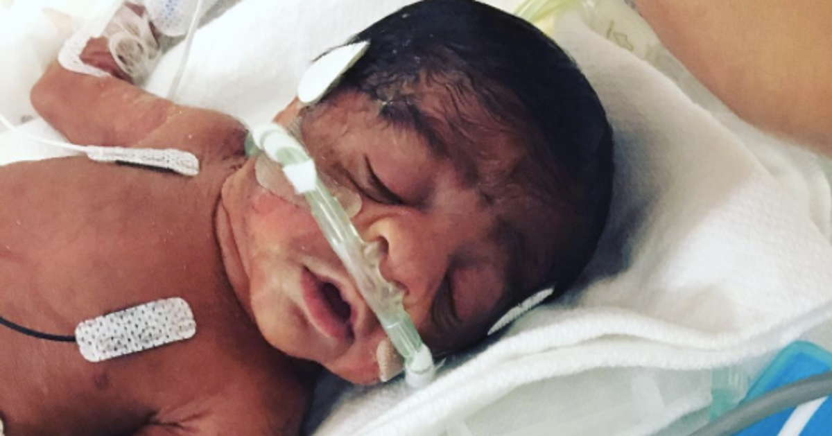 An Intimate Look At A Micro Preemie's First Days | HuffPost Life