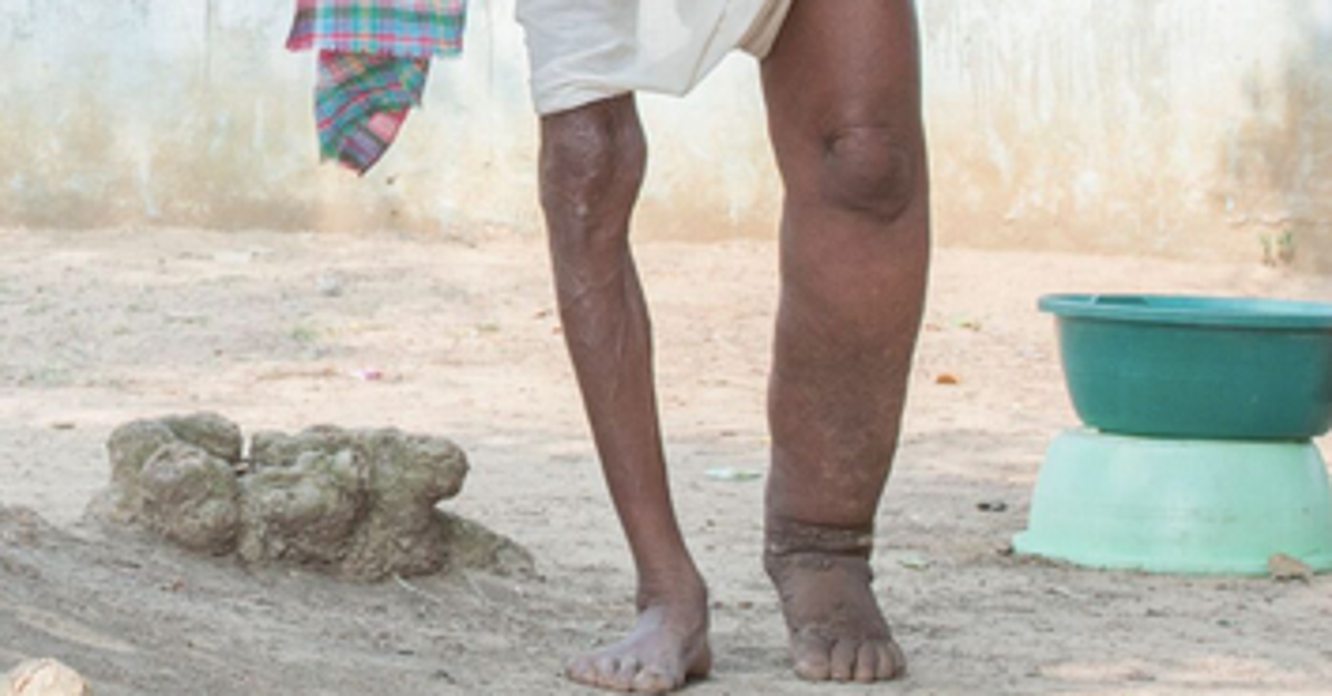 This Group Helps Fight Devastating Diseases The World Ignores ...