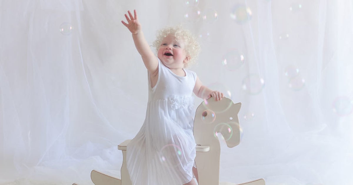 Stunning Photo Series Captures The Beauty Of People With Albinism ...