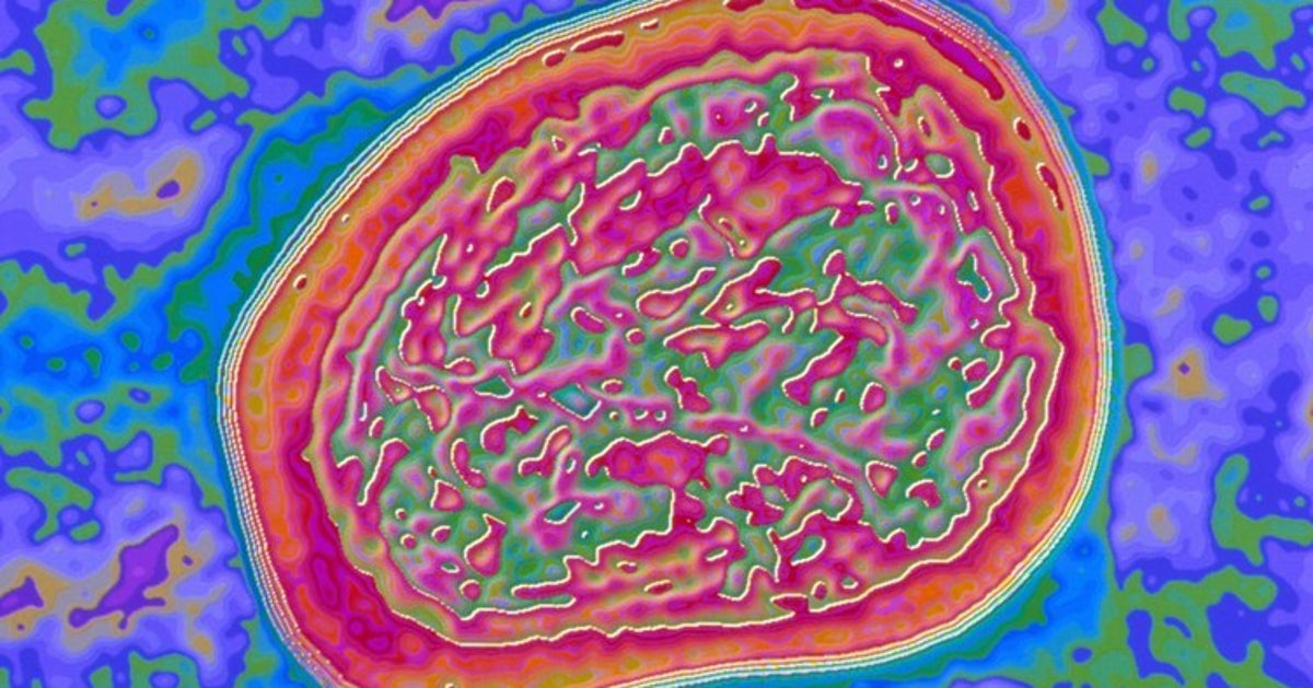 Mumps Cases Are The Highest They've Been In 10 Years | HuffPost Life