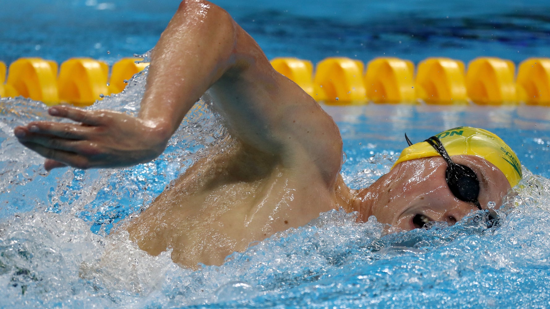 Gold-Medal Swimmer Thanks Eagle-Eyed Fan Who Spotted Suspicious Mole ...
