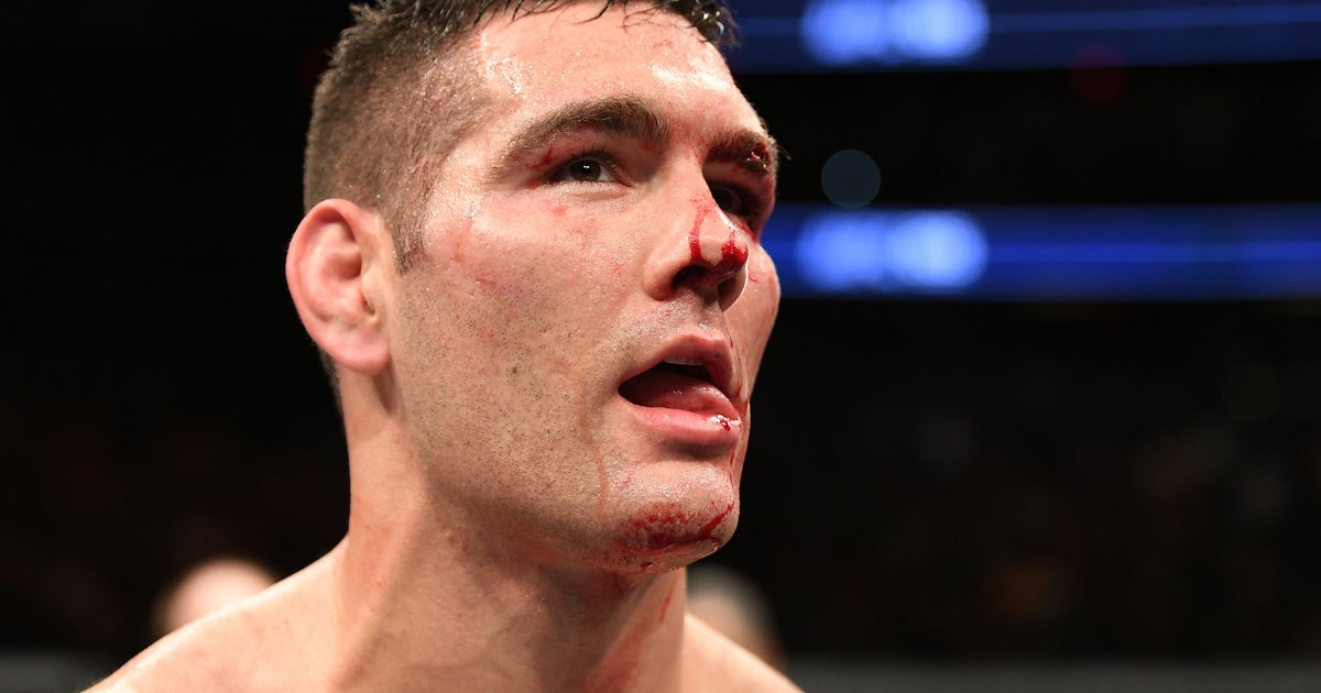 The Extreme Way UFC Champ Chris Weidman Lost 32 Pounds In 10 Days ...